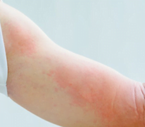 4h2 Pill: Uses, Dosage, Side Effects & Precautions - Health Plus City